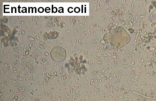 Balantidium coli