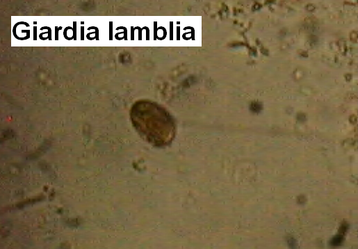 Entamoeba histolytica